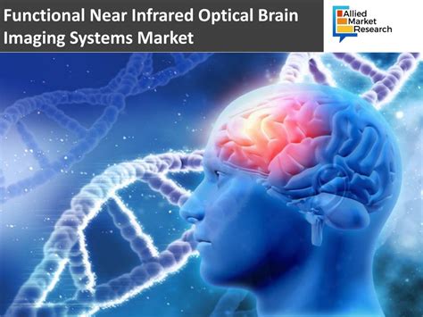 Ppt Functional Near Infrared Optical Brain Imaging Systems Market