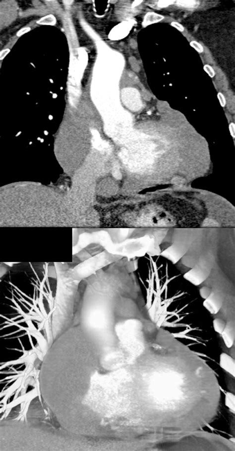 Cardiac Learning Modules Ct Scanning