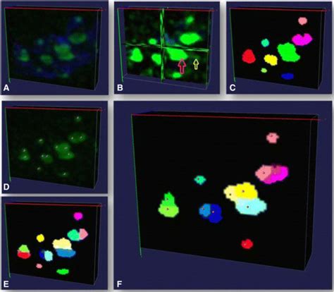 Synapse Clump Splitting A Original Image With Green Signal Being Download Scientific Diagram