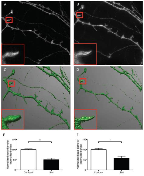 Representative Micrographs Of Dendrites And Dendritic Spines Imaged