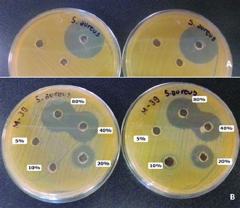 Ensayo De Difusión En Agar Con Pozos Para La Determinación De Efecto