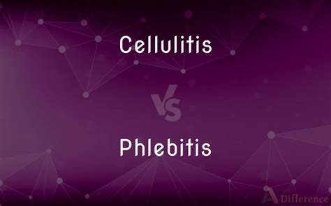 Cellulitis Vs Phlebitis Whats The Difference