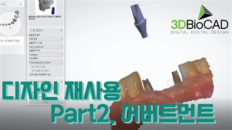 3shape Dentalsystem 디자인 재사용 기능 Part2 어버트먼트 Youtube