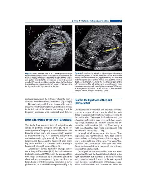 Echocardiographic Anatomy In The Fetus 2009 Pg Pdf