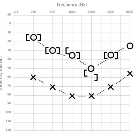 Audio LAB Quiz 8 Flashcards Quizlet