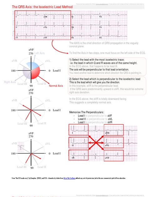 Ecg Interpretation Axis And Conduction Abnormalities Pdf