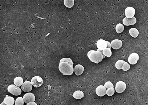 Free Picture Positive Staphylococcus Aureus Bacteria