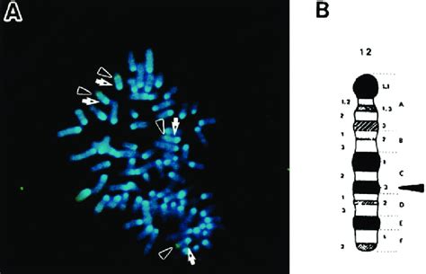 A Chromosomal Localization Of Striamin On Mouse Metaphase Chromosomes