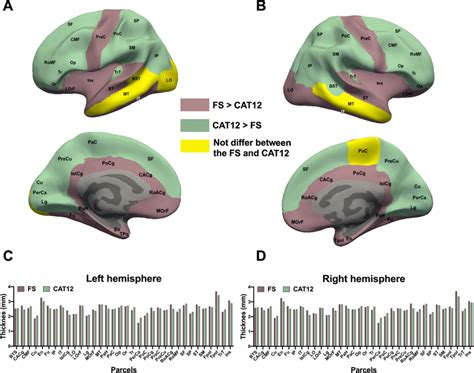 Representation Of Regions With Significantly Different Cortical