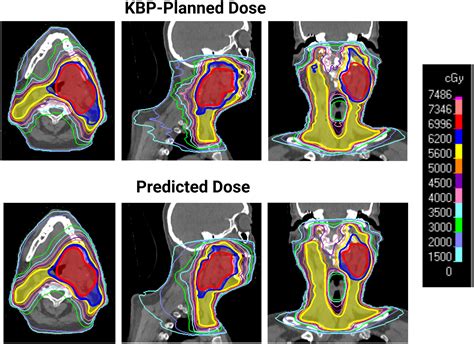 Deep Learningbased Dose Prediction For Automated Individualized Quality Assurance Of Head And
