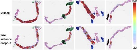 A Multi Resolution Model For Histopathology Image Classification And