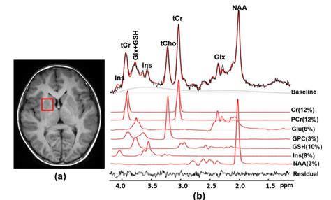 Phenomics 吴敏团队联合张孝勇团队揭示儿童抽动障碍严重程度与谷氨酸的关系 知乎