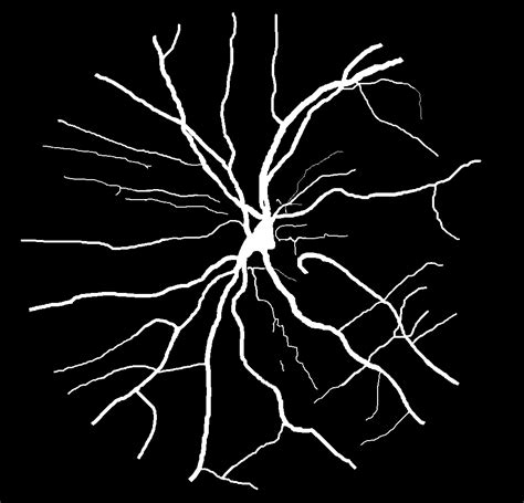 I Need Some Help With My Segmentation Model PyTorch Forums
