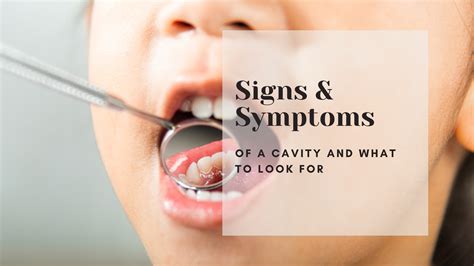 Signs And Symptoms Of A Cavity What To Look For — Sun Dental Group