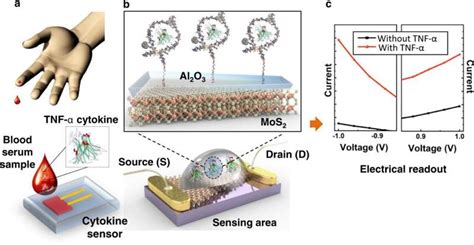 cientistas desenvolvem sensor de detecção precoce da doença de alzheimer