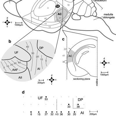 Frontal Section Through The Left Side Auditory Cortex Of A Mother Download Scientific Diagram