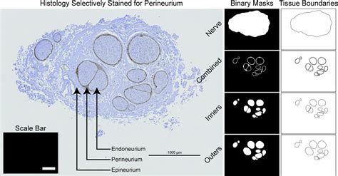 How To Process Histology Images Into Binary Boundary Maps Image