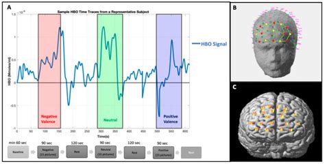 A Experimental Protocol And Stimulus Timing A Sample Time Trace Of Download Scientific