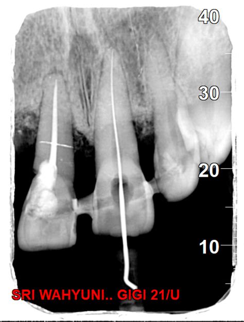 Yolo V8 Kim Object Detection Dataset And Pre Trained Model By Deteksi