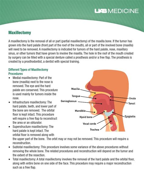 Maxillectomy Different Types Of Maxillectomy Procedures Pdf Surgery Wound