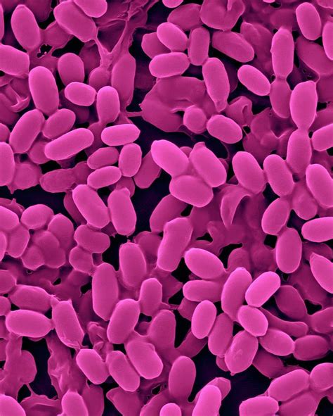 Bird And Mammal Pathogen Pasteurella Multocida 1 By Science Photo