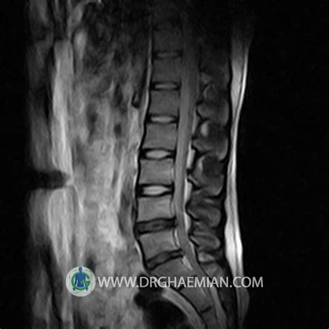 ام آر آی کمر چیست و چرا انجام می شود؟ مرکز تصویربرداری دکتر قائمیان