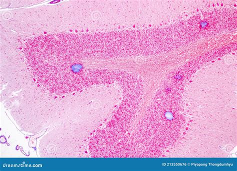 Spinal Cord Nerve Cerebellum Cortex And Motor Neuron Human Under The Microscope Stock Photo