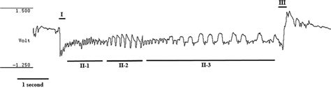 The Waveform Of A Potential Drop Viewed On Windaq Waveform Browser Download Scientific Diagram