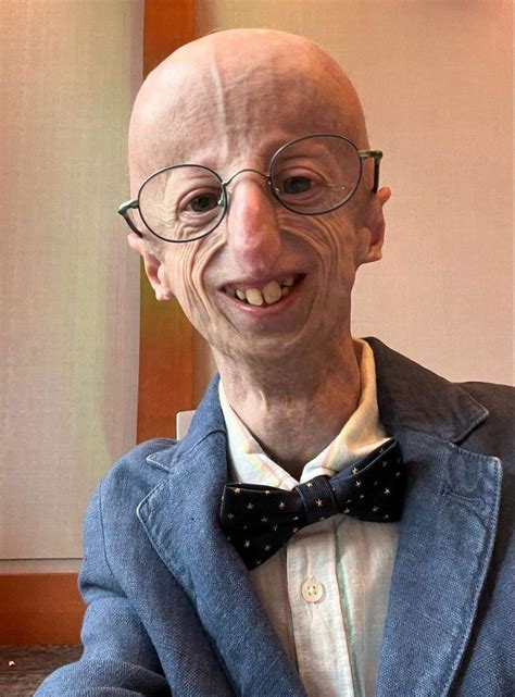 Muere Sammy Basso El Científico Italiano Que Visibilizó La Progeria A Los 28 Años