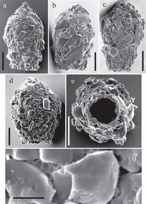 Different Specimens Of Difflugia Amphoralis From C Ogdens Sem