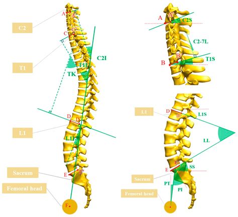 Machine Learning Based Measurement Of Regional And Global Spinal