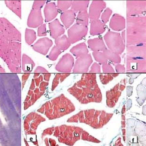Photomicrographs Showing Transverse Section Ts Of A Control Rat