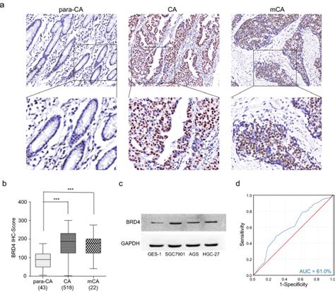 Inhibition Of Brd4 Enhanced The Tumor Suppression Effect Of Dasatinib In Gastric Cancer Pmc