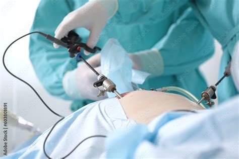 Surgical Teamlaparoscopic Instruments In The Hands Of A Surgeon