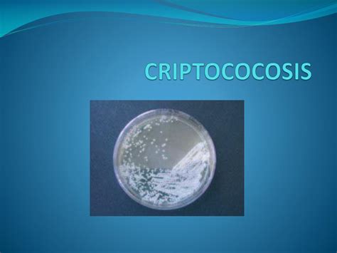Ppt Criptococosis Powerpoint Presentation Free Download Id 948509