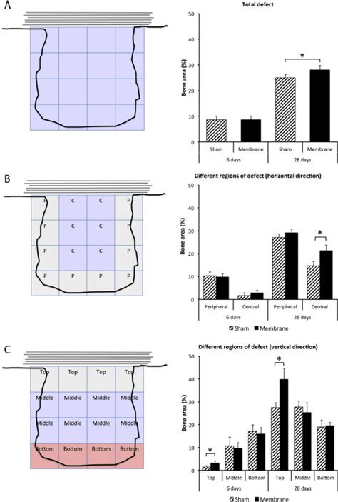 Histomorphometry Analysis Of Bone Formed In Defects With Or Without Download Scientific Diagram
