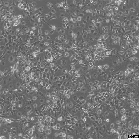 Mda Mb 436 Cells