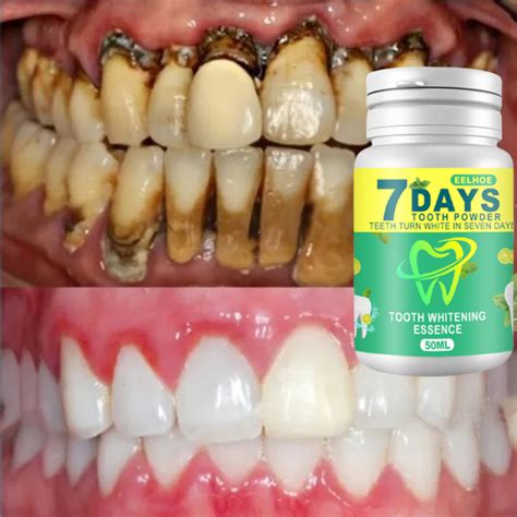 7 Days Teeth Cleansing Whitening Powder Removes Stains Oral Hygiene