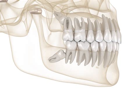 What Is An Impacted Tooth — Elite Oral And Facial Surgery Long Island