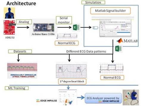 arduino based ecg electrocardiogram signal analyzer open