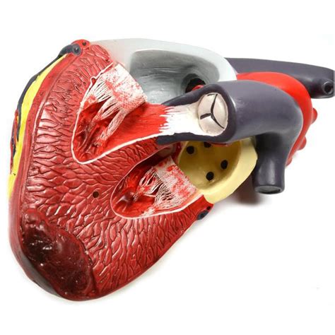 Heart Pathologies And Conditions