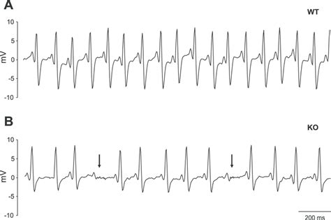 Representative Surface Ecg Recordings From Anesthetized Mice A Download Scientific Diagram