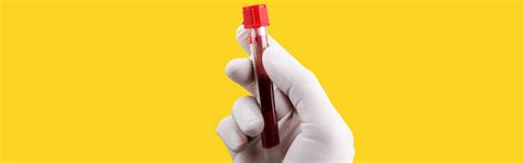 Testosterone Tracking Triglycerides To HDL And How To Get More Accurate Information From Blood