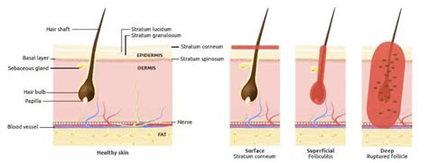 Canine Pyoderma A Common Dermatological Challenge Nationwide