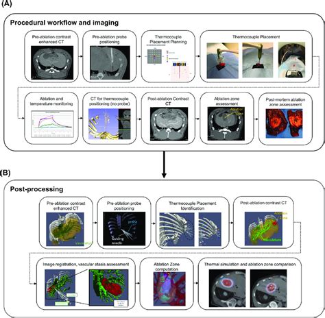 Procedural Workflow Imaging And Post Processing Steps Towards Download Scientific Diagram