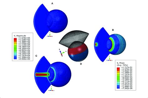 Fluid Structure Interaction Fsi Model Of The Air Puff Test A Download Scientific Diagram