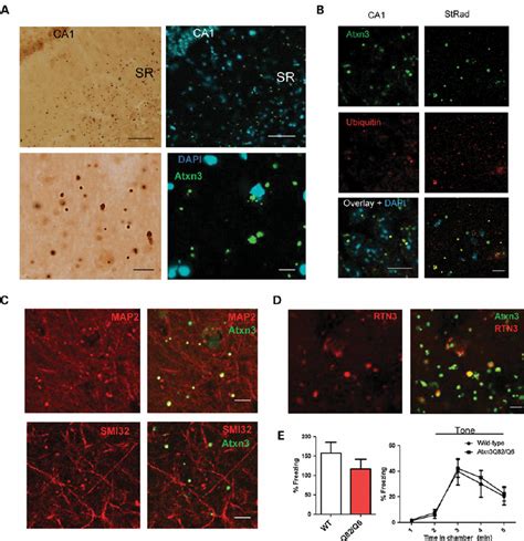 Extranuclear Inclusions In The Hippocampus Of Sca3 Knockin Mice A Download Scientific