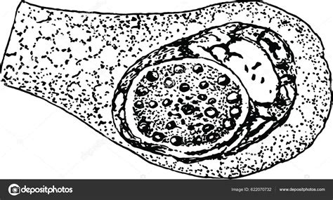 Formación Cyclospora Cayetanensis Egg Cell Vintage Illustrat Vector De Stock Por ©yay Images