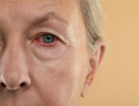 How Quickly Does Glaucoma Progress Eye Care Professionals