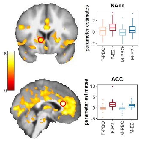 E Induced Differences In RPE Related Activity The Activity Enhancing Download Scientific